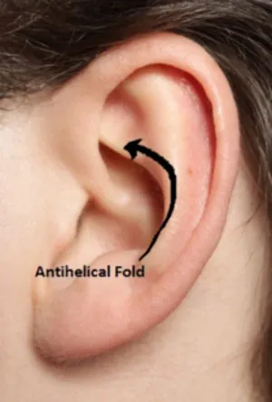 Ear Surgery in Surprise AZ | Protruding Ears | Otoplasty